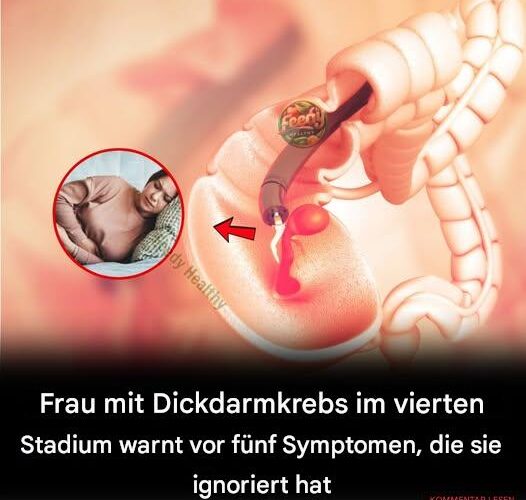 Darmkrebs Bei Frauen Subtile Symptome Die Nicht Ignoriert Werden Solltenfeed